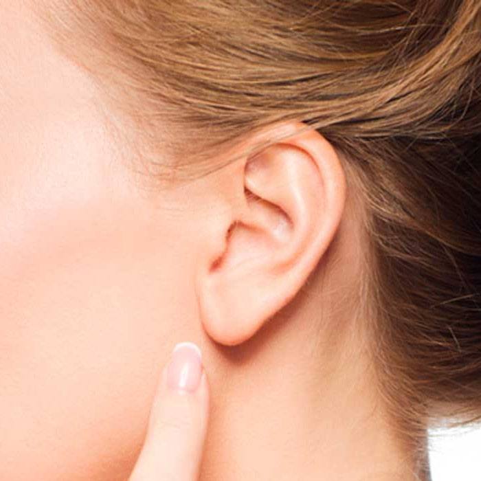 Orejas Mujer - Slaser Depilación Láser en Cartagena